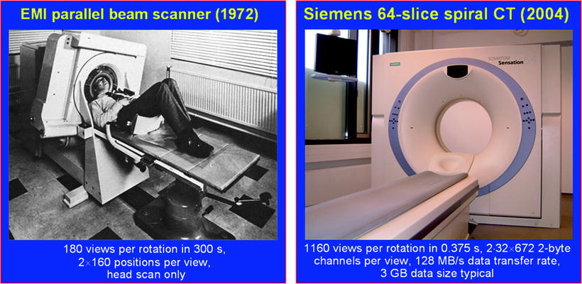 Principles, Design, and Operation of Multi-slice CT | SpringerLink