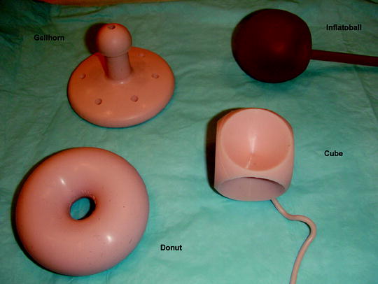 Pessary | SpringerLink