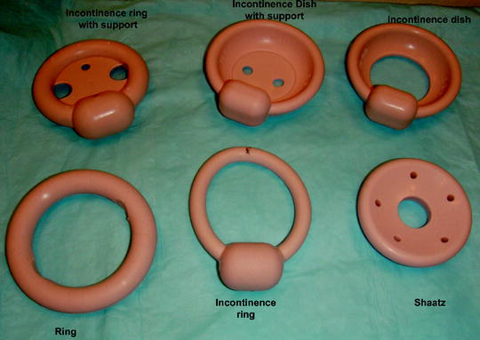 Pessary | SpringerLink