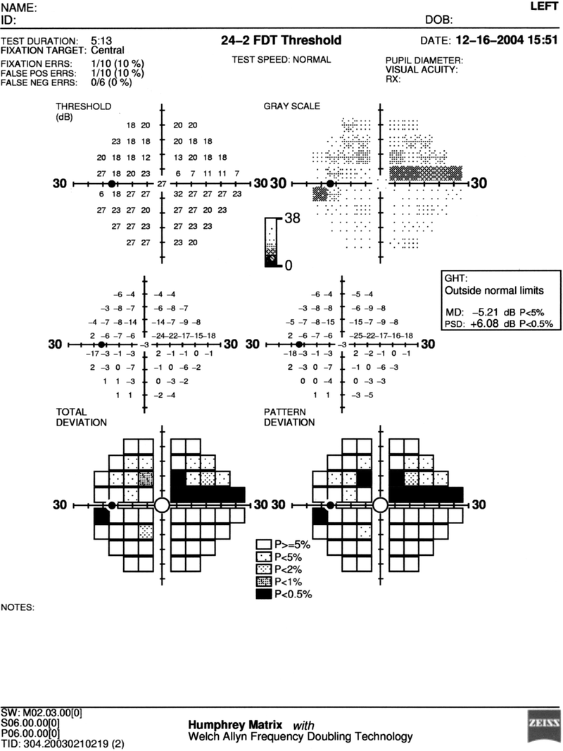 Detecting Functional Changes in the Patient’s Vision: Visual Field ...