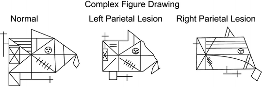 Deficits in Visuospatial/Visuoconstructional Skills and Motor Praxis ...