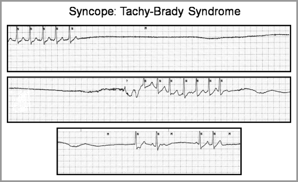 Cardiac Arrhythmias | SpringerLink
