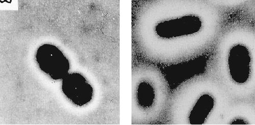 Importance of Acinetobacter spp. | SpringerLink