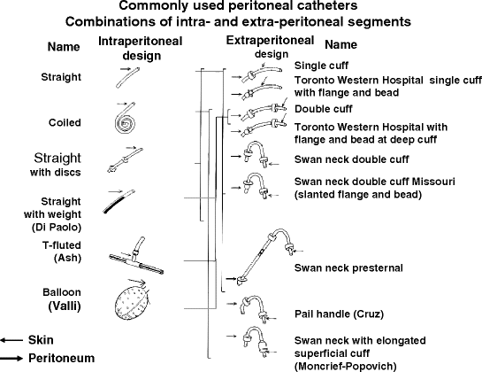 Peritoneal Dialysis Access and Exit-Site Care Including Surgical ...