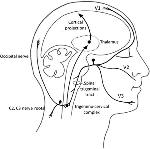 Post-traumatic Headache | SpringerLink