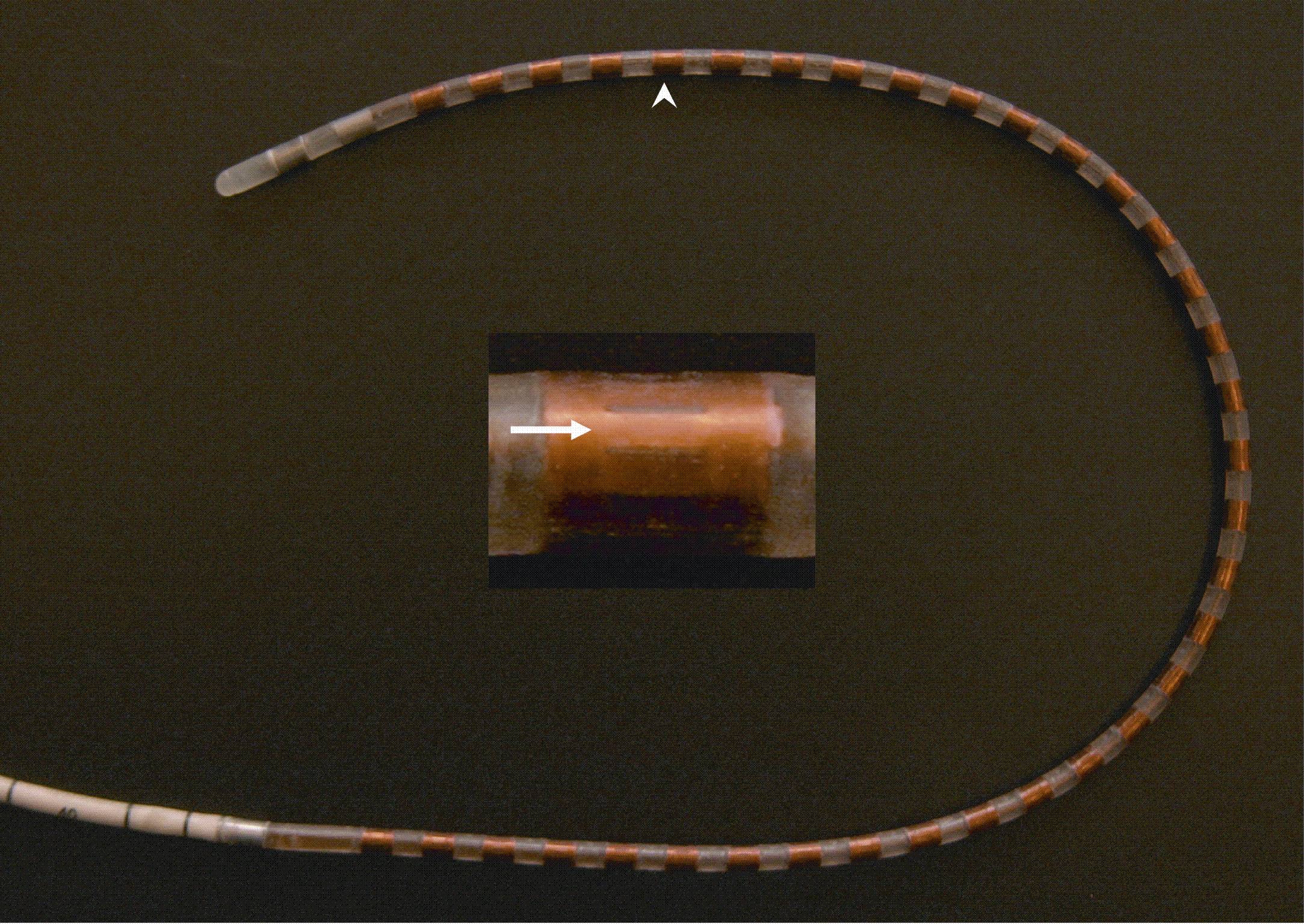 Introduction to High-Resolution Manometry | SpringerLink