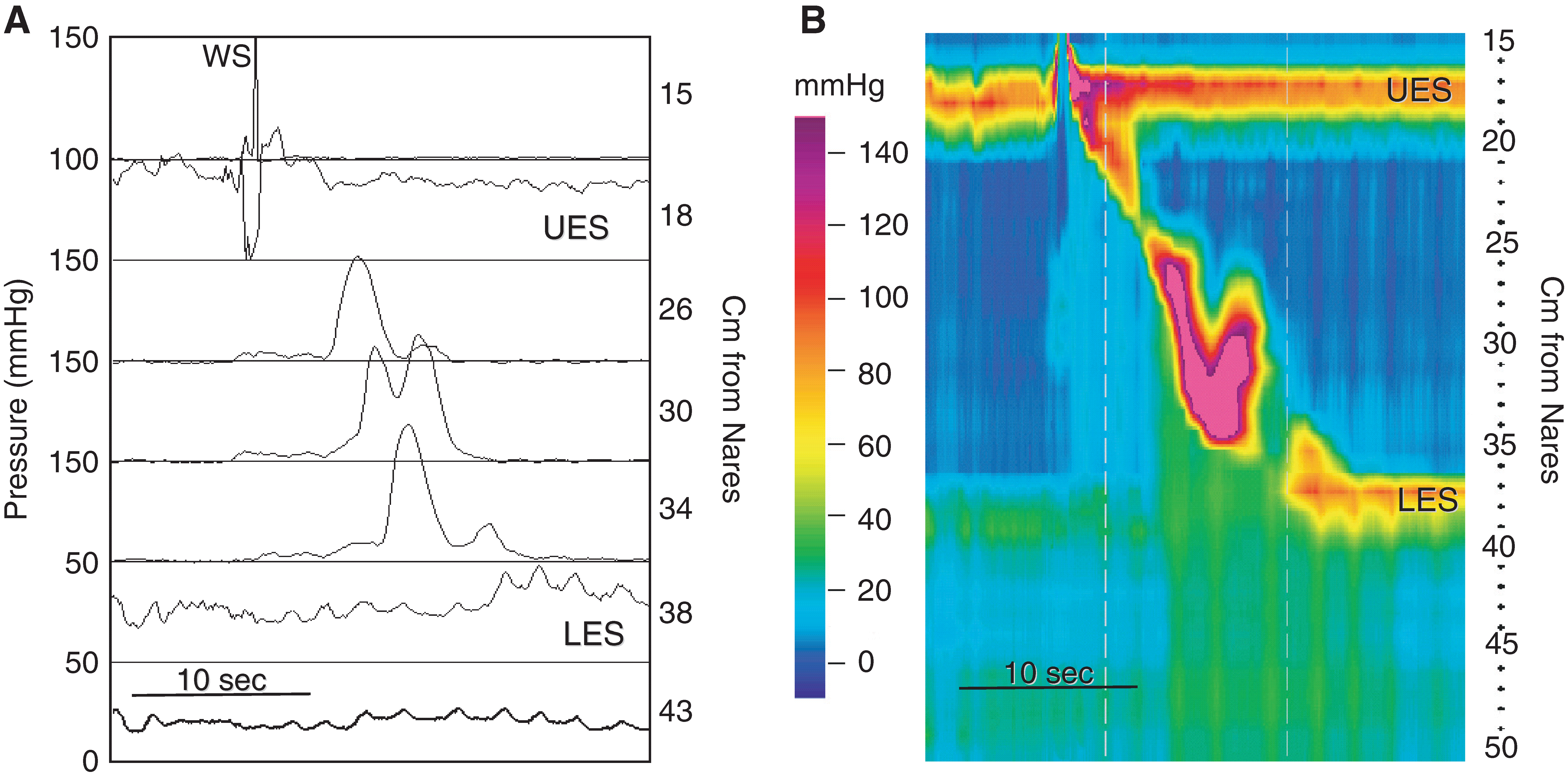 Esophageal Manometry | SpringerLink
