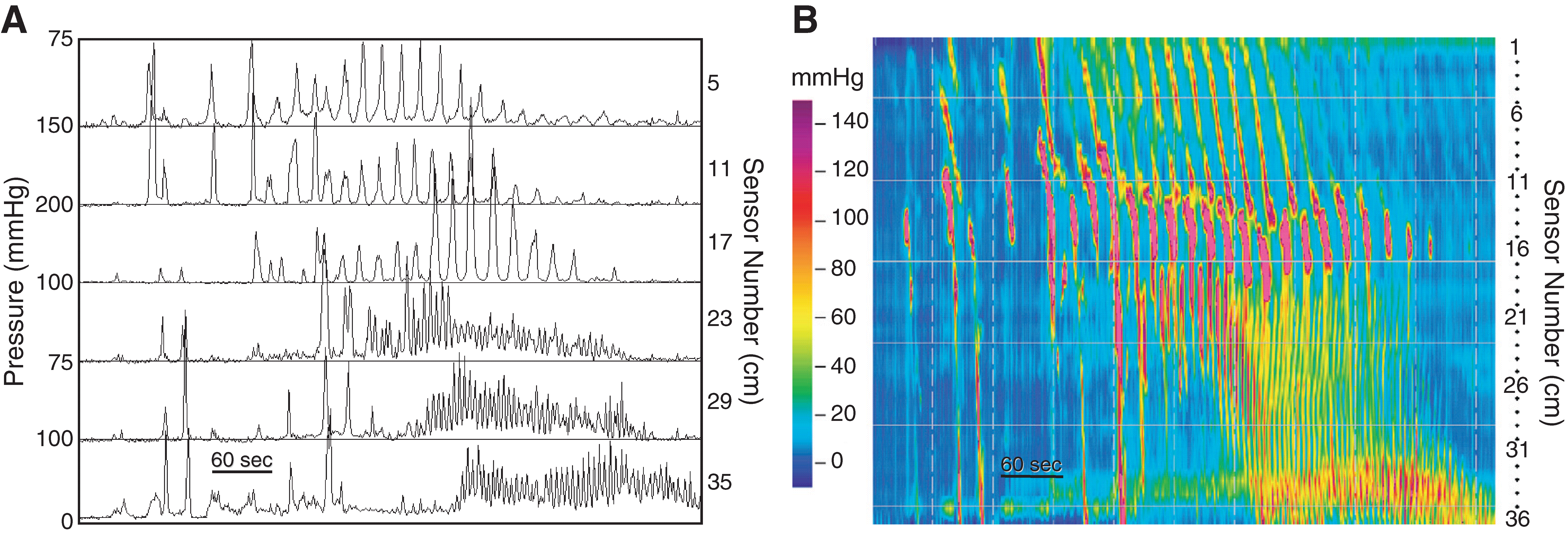 Gastric/Small Bowel Manometry | SpringerLink