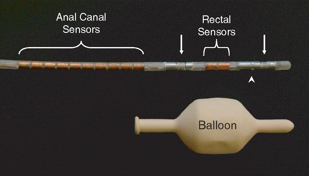 Anorectal Manometry | SpringerLink