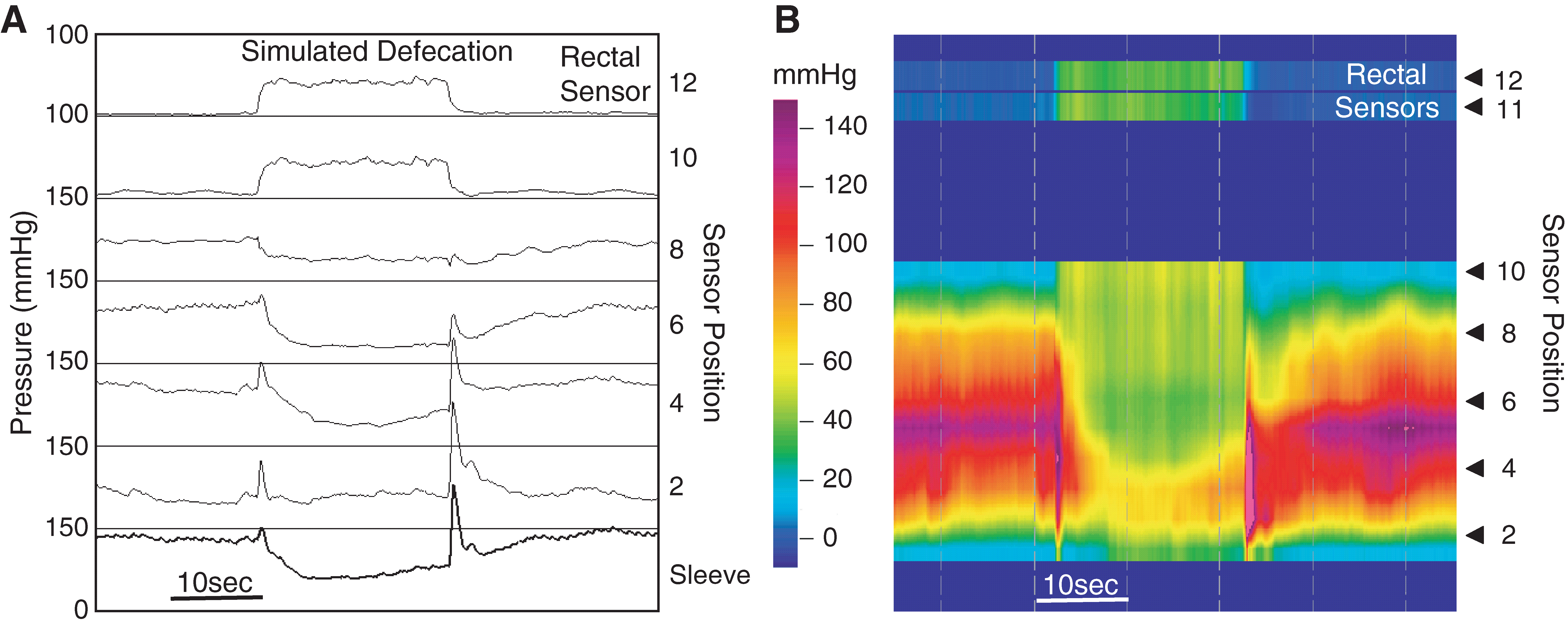 Anorectal Manometry | SpringerLink