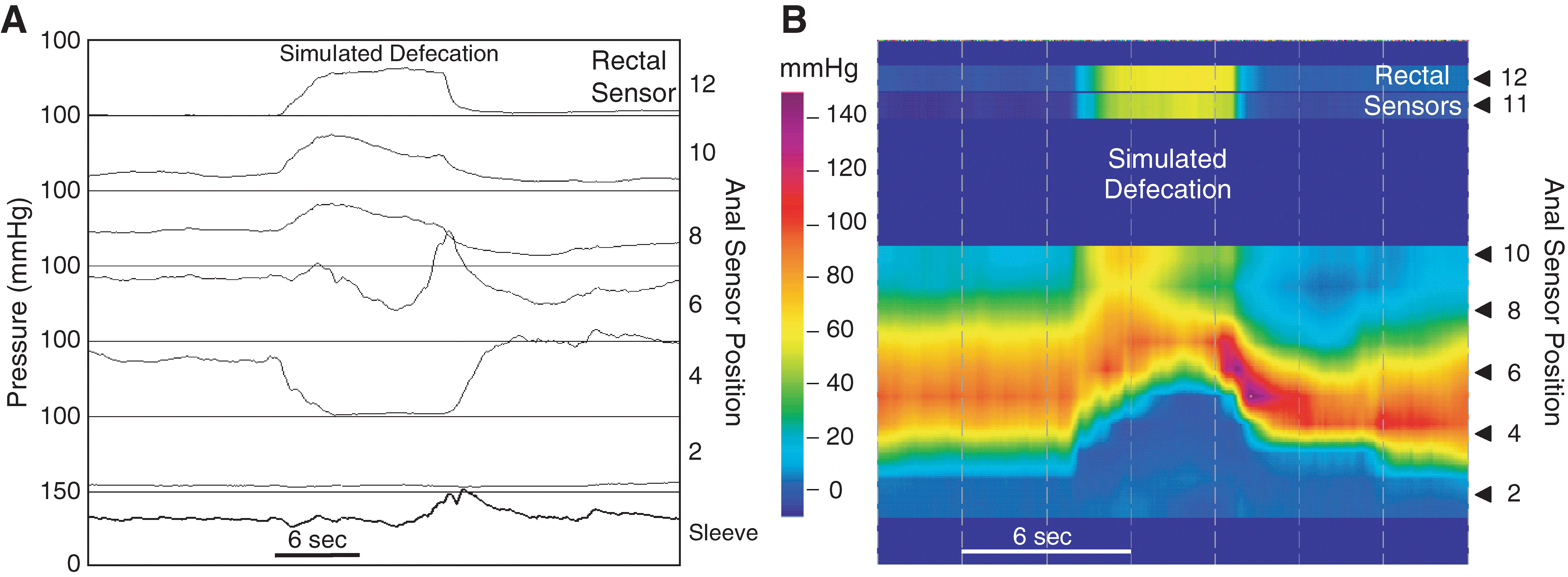 Anorectal Manometry | SpringerLink