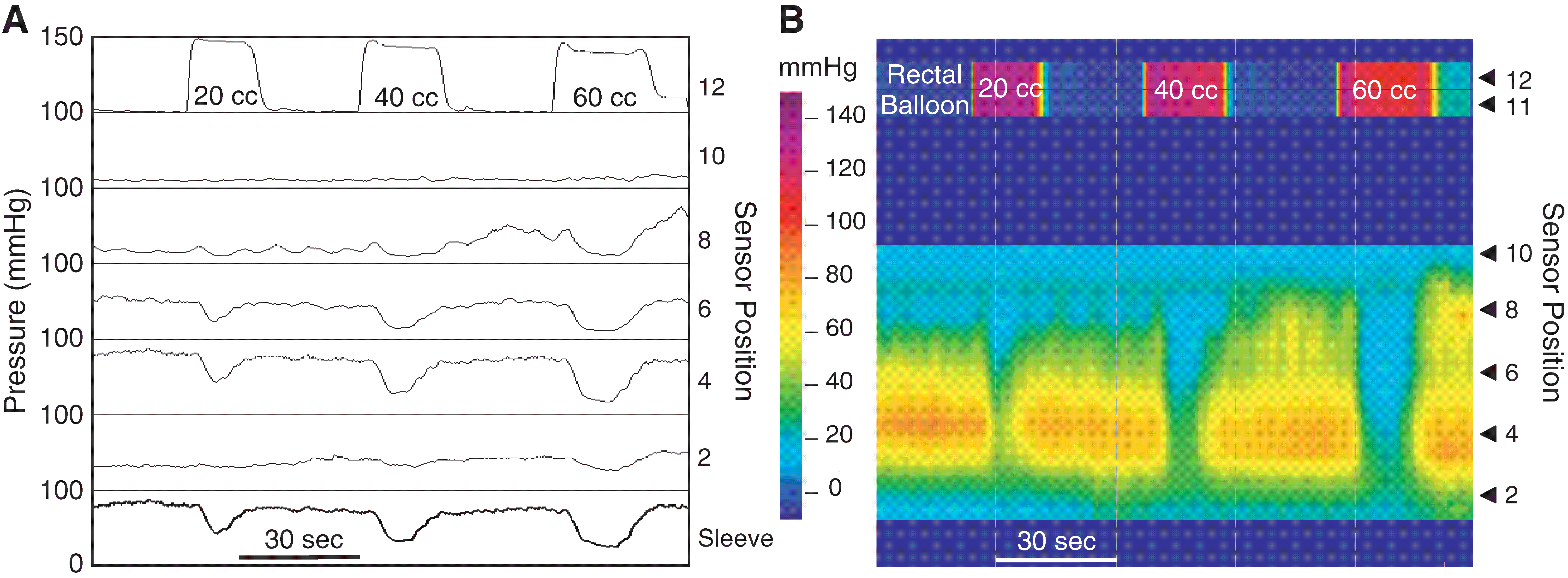 Anorectal Manometry | SpringerLink