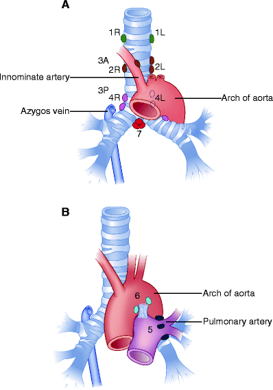 Mediastinoscopy | SpringerLink