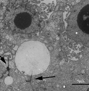 Artifacts in Transmission Electron Microscopy | SpringerLink