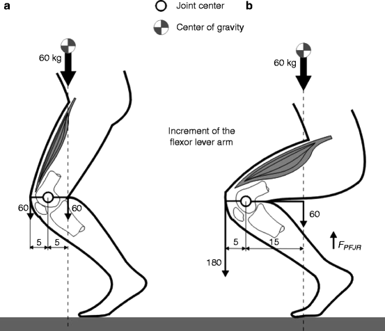 Biomechanical Bases for Anterior Knee Pain and Patellar Instability ...