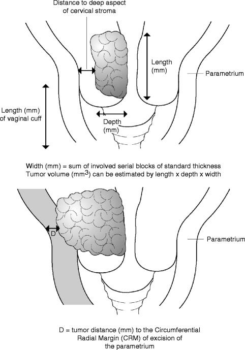 Cervix | SpringerLink