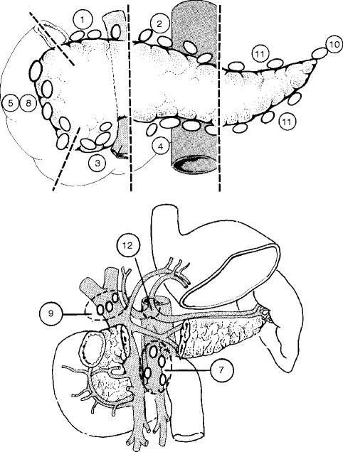Pancreas, Duodenum, Ampulla of Vater and Extrahepatic Bile Ducts ...