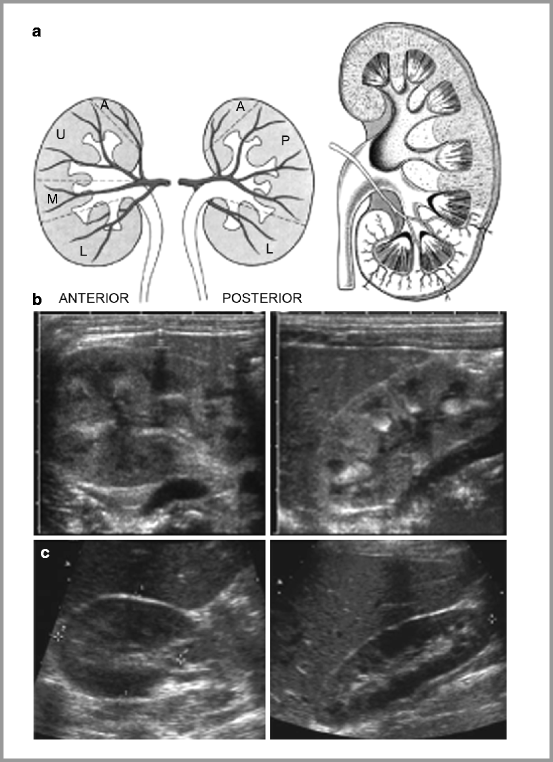 Overview, Structure and Function of the Nephron | SpringerLink