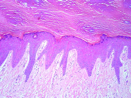 Normal Cutaneous Histology | SpringerLink