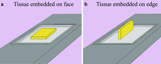 Embedding of Tissue for Frozen Section | SpringerLink