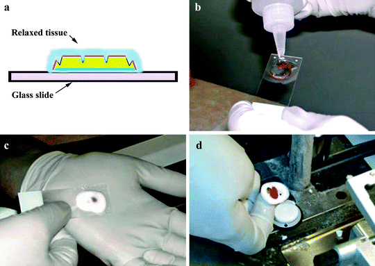 Frozen Section Techniques Used in Mohs Micrographic Surgery | SpringerLink