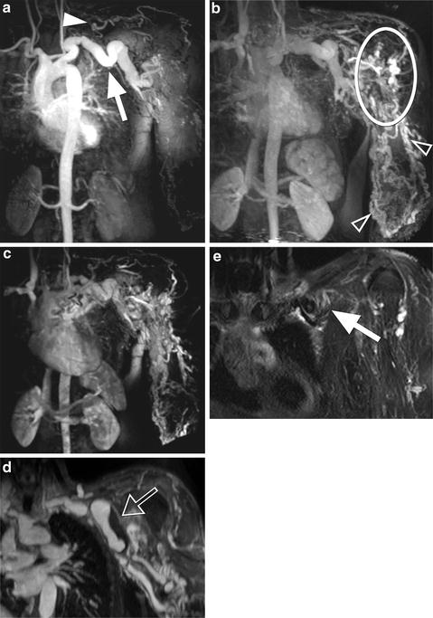 MRA: Upper Extremity and Hand Vessels | SpringerLink