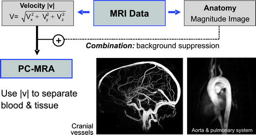 Phase-Contrast MRI and Flow Quantification | SpringerLink
