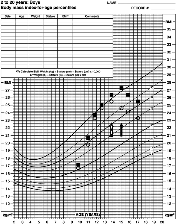 Growth in Duchenne Muscular Dystrophy | SpringerLink