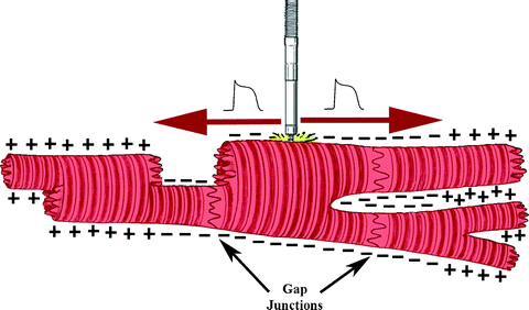 Anatomy and Physiology of the Cardiac Conduction System | SpringerLink