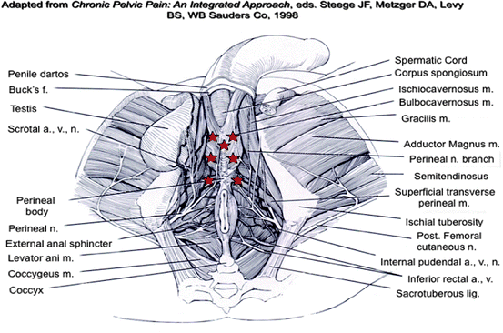 Pelvic Floor Dysfunction in Bladder Pain Syndrome | SpringerLink