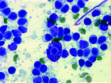 Cytology of Normal/Reactive Lymph Nodes | SpringerLink