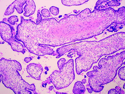 Chorionic Villi: Histology and Villous Development | SpringerLink