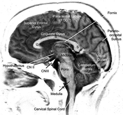 Diencephalon with Atlas of the Thalamus | SpringerLink