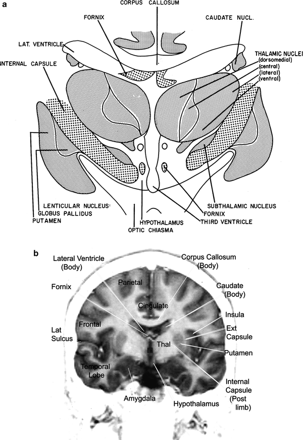 Diencephalon with Atlas of the Thalamus | SpringerLink
