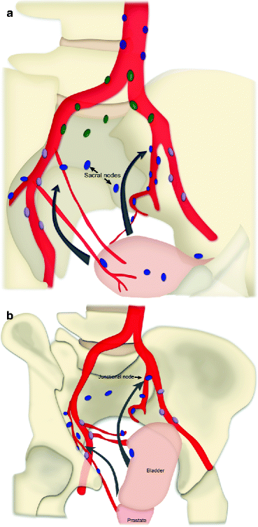 Pelvic Lymph Nodes | SpringerLink