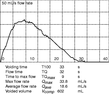 Principles of Measurement of Urinary Flow | SpringerLink