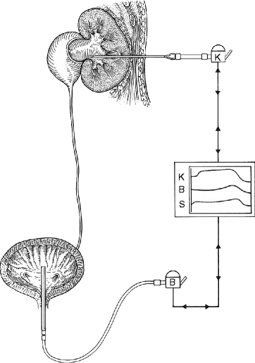 The Whitaker Test | SpringerLink