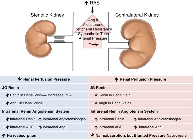 Interaction Between Stenotic and Contralateral Kidneys: Unique Features ...