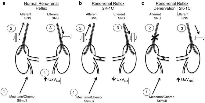 Interaction Between Stenotic and Contralateral Kidneys: Unique Features ...