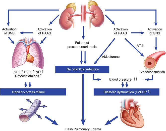 Cardiorenal Syndromes: Renal Artery Disease and Congestive Heart ...