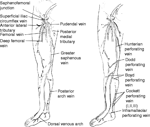 Overview of Venous Disorders | SpringerLink