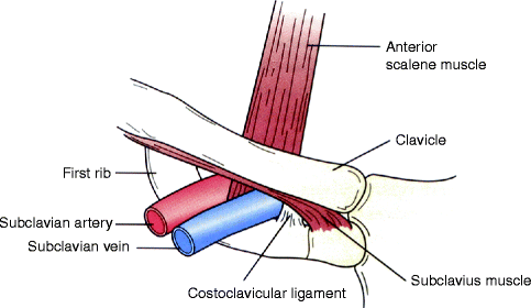 Anatomy of the Thoracic Outlet and Related Structures | SpringerLink