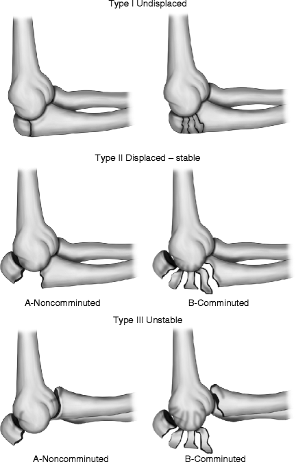Shoulder and Upper Limb | SpringerLink