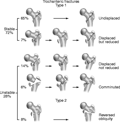 Pelvis and Lower Limb | SpringerLink