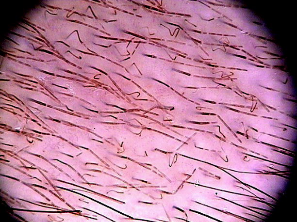 Hair Shafts | SpringerLink