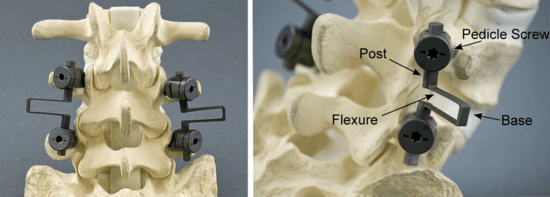 Compliant Mechanisms | SpringerLink