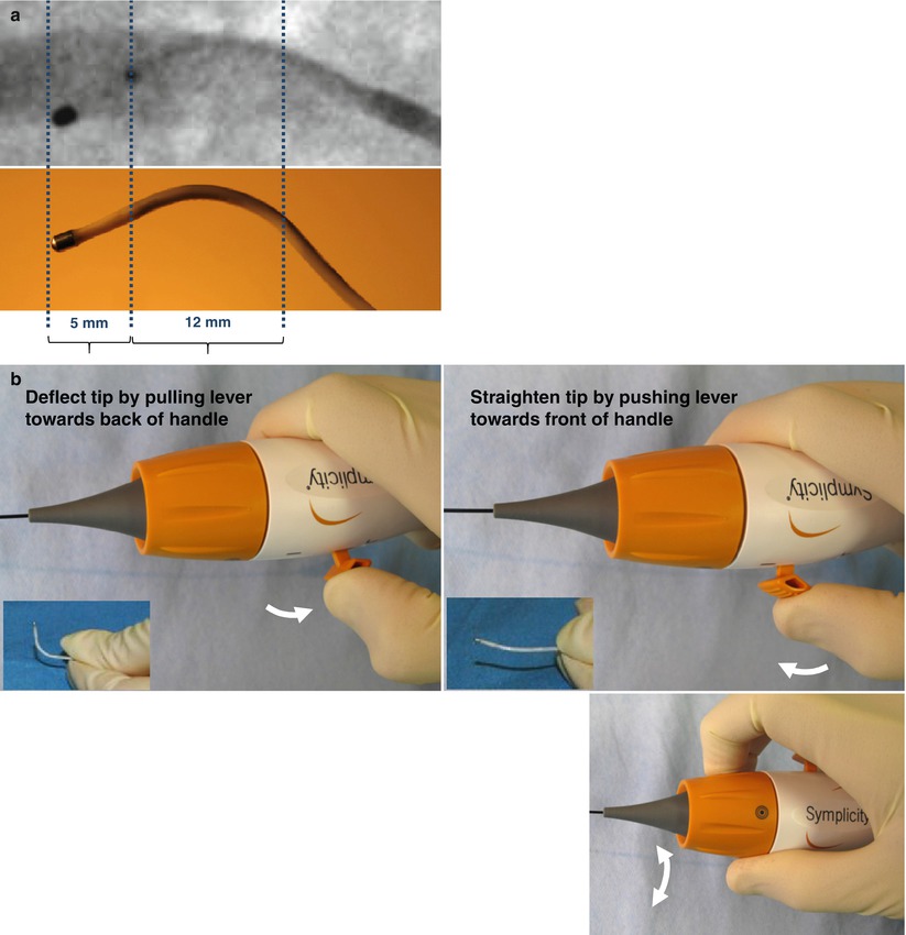 Medtronic Ardian Symplicity™ Renal Denervation Devices | SpringerLink