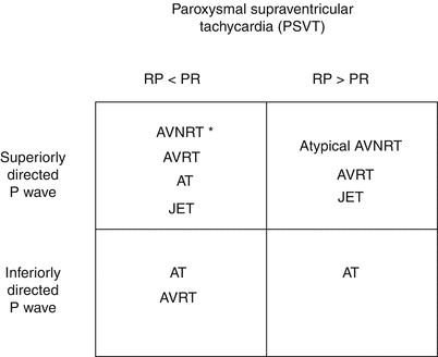 How to Differentiate Between AVRT, AT, AVNRT, and Junctional ...