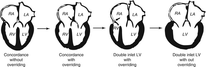Abnormal Cardiac Anatomy | SpringerLink