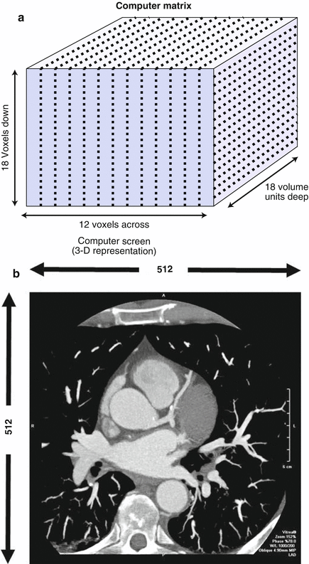 Basic Principles in Computed Tomography (CT) | SpringerLink